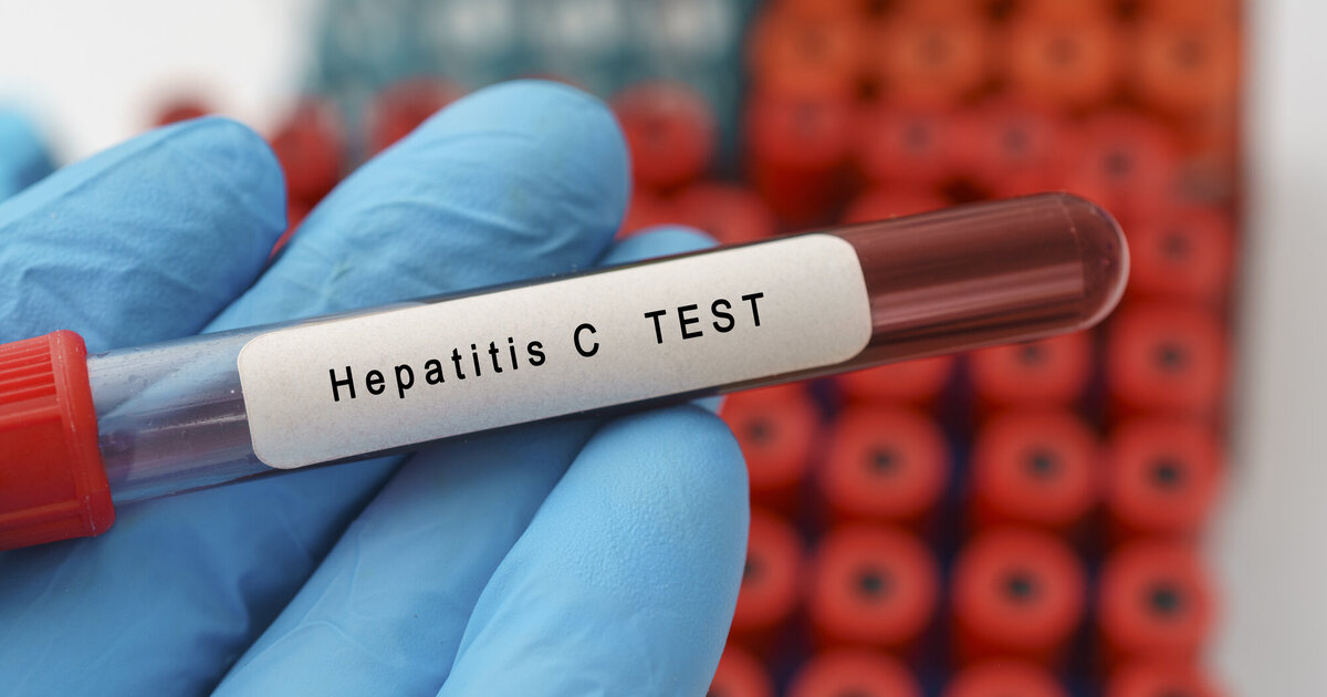 Samleartikkel: Hepatitt | Sykepleien