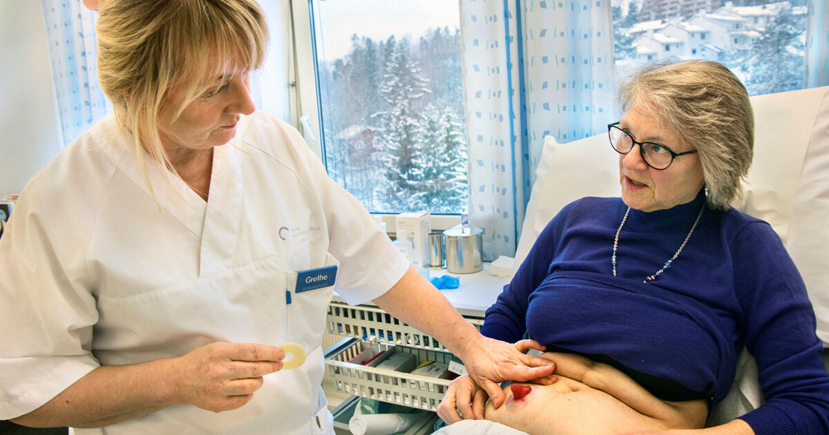 Livet med stomi: – Det var så sinnssykt vondt. Såret var jo et krater ...